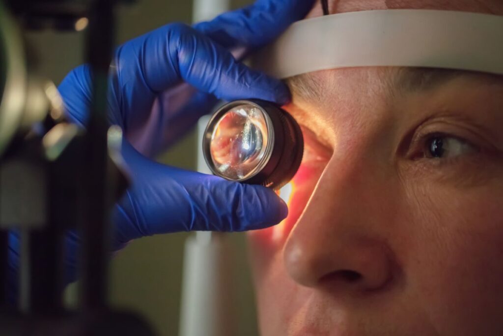 ¿Cuáles son los diferentes tipos de cirugía para miopía y cómo elegir ...